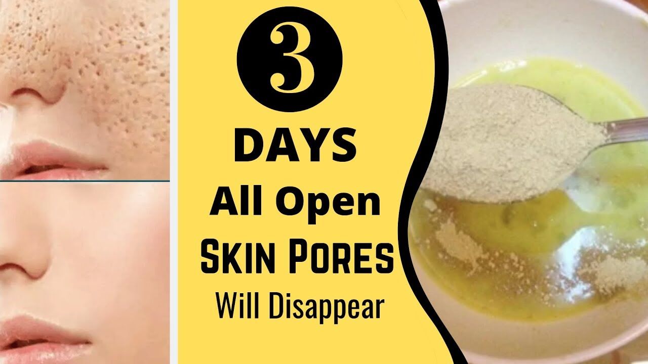 3 Days and All Open Pores Will Disappear from Your Skin Permanently